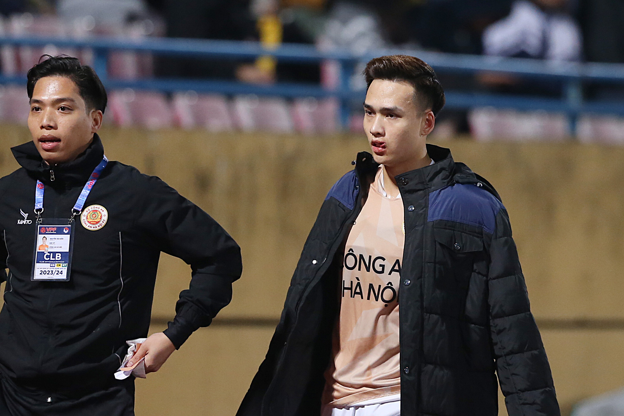 Tuyển thủ Bùi Hoàng Việt Anh đi cấp cứu vì rách đôi môi - Tuổi Trẻ Online