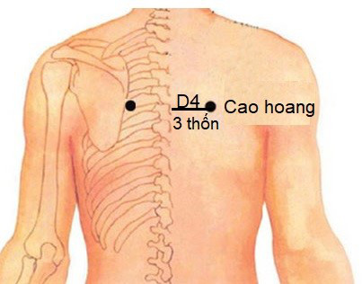 Luyện tập huyệt cao hoang có thể cứu cả tính mạng - Tuổi Trẻ Online