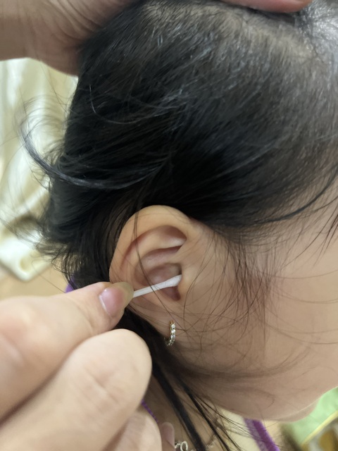 Có nên làm sạch, lấy ráy tai cho trẻ mỗi ngày? - Tuổi Trẻ Online