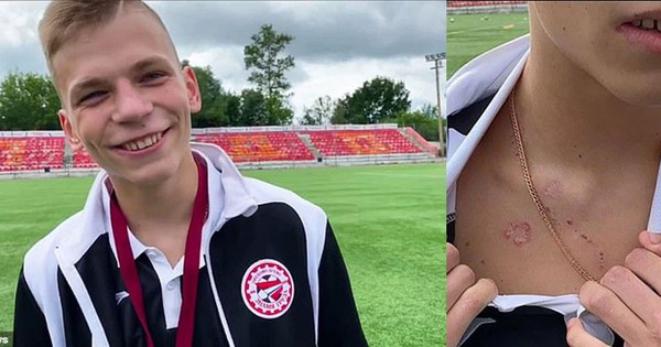 Thủ môn bị sét đánh trên sân tập bình phục kỳ diệu sau 3 tuần - Tuổi ...