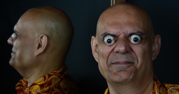 Kỷ lục Guinness không dành cho người yếu tim: Mắt lồi nhất thế giới ...